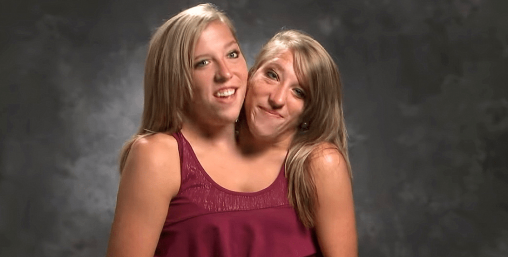 How is Misty Loman doing in 2022? She is free from drugs and is still ...